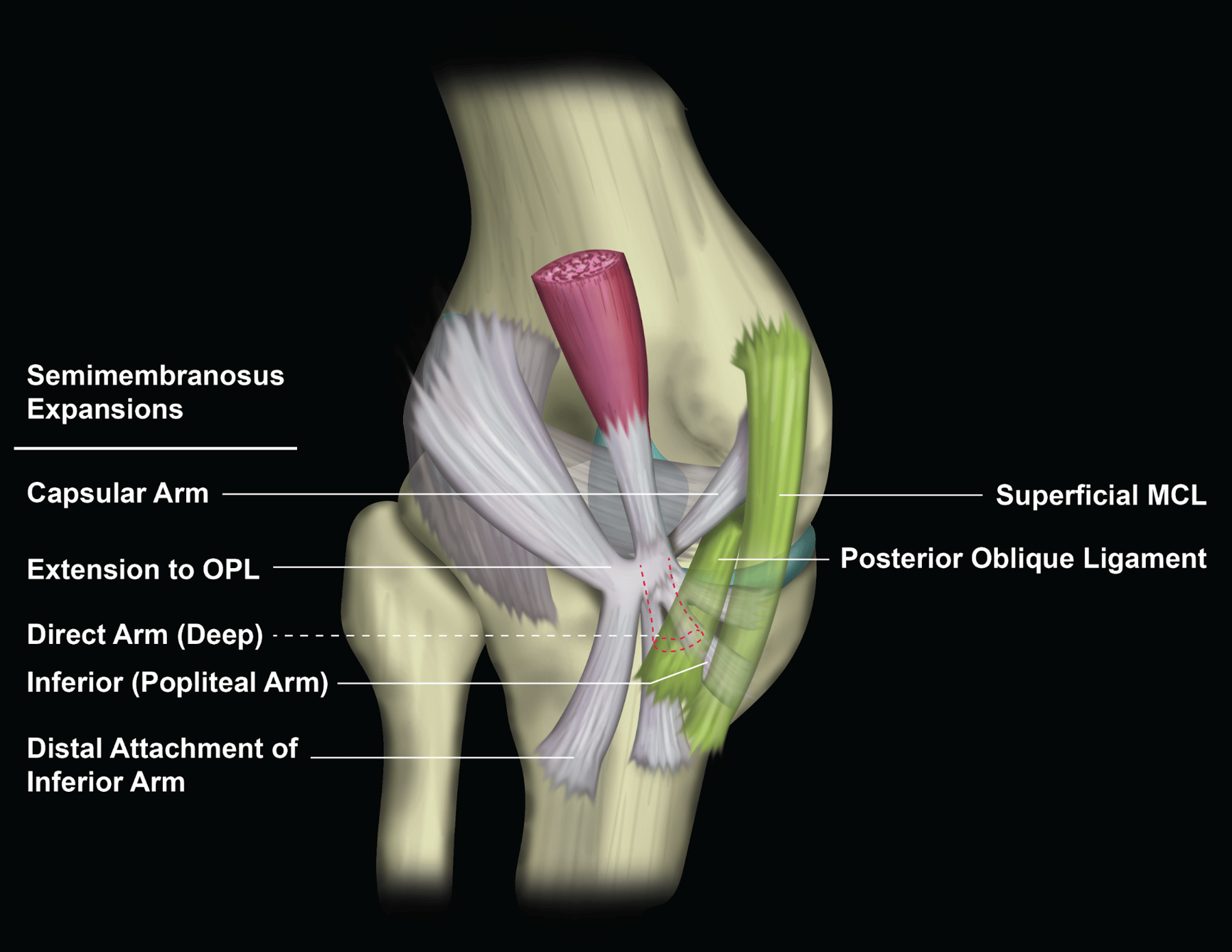 Posteromedial Corner - ProScan Education