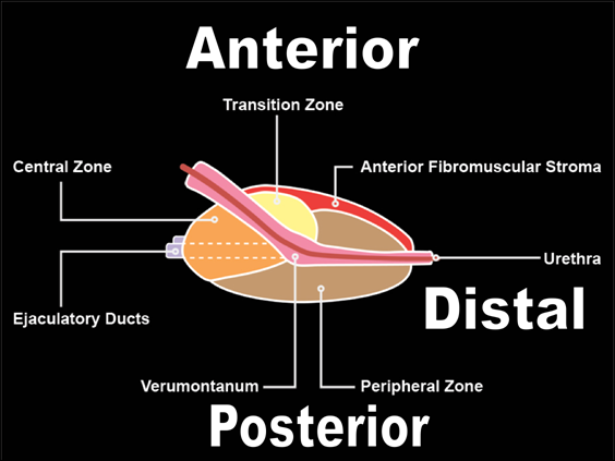 Prostate MRI Reference Guide - PI-RADS version 2