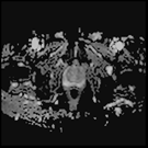 Prostate MRI Reference Guide - PI-RADS version 2